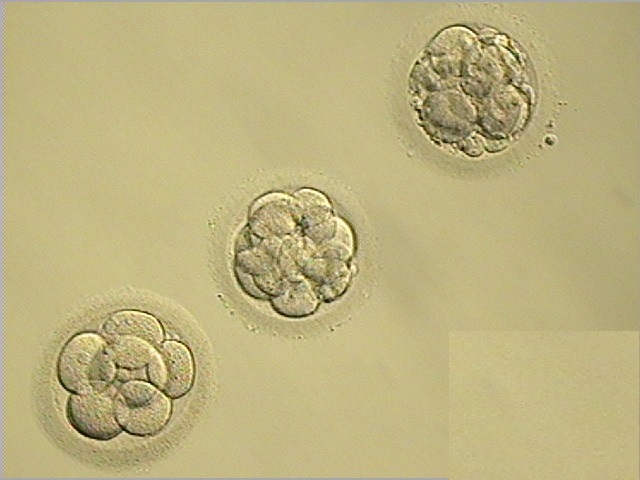 Understanding Embryo Grading - Genesis Fertility New York