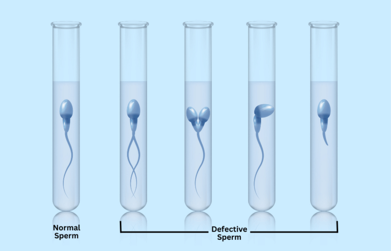 What you need to know about semen analysis - GENESIS Fertility & Reproductive Medicine
