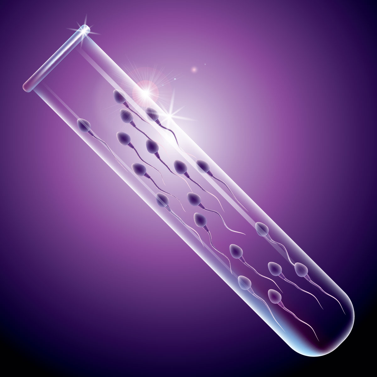 What you need to know about semen analysis - GENESIS Fertility ...