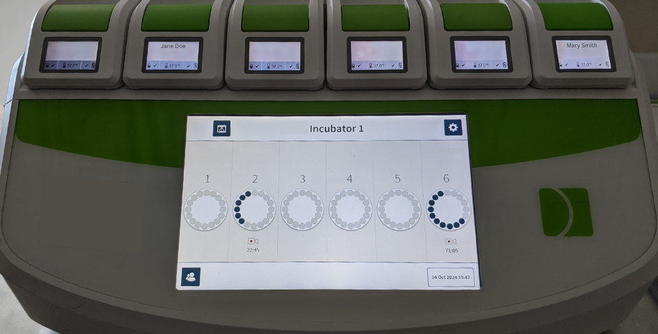 The benefits of time-lapse incubators - Genesis Fertility & Reproductive Medicine